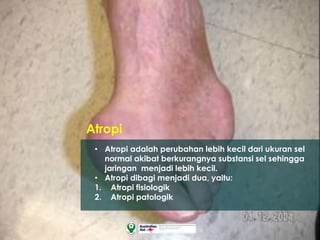 Kelainan retrogresif | PPTX