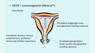 mengenai bermacam-macam jenis KB serta kontraindikasi penggunaan KB | PPTX
