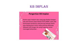 materi penyuluhan KB IMPLAN power point ppt .pptx