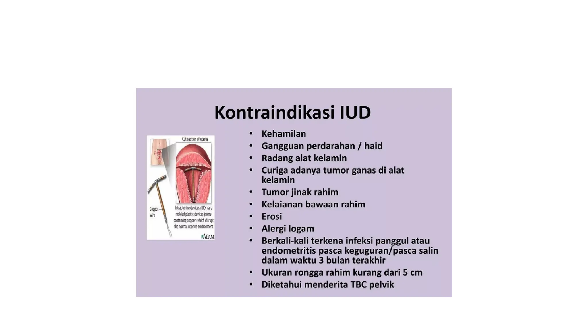 materi penyuluhan KB IUD power point.pptx