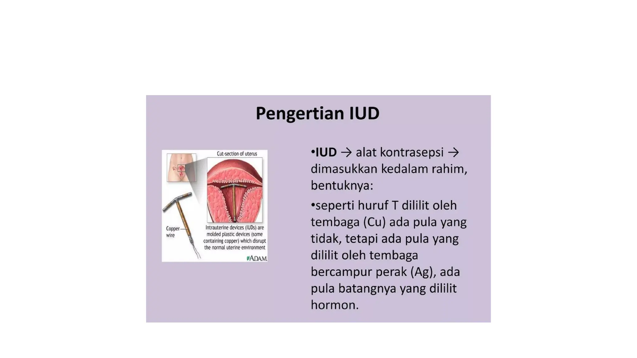 materi penyuluhan KB IUD power point.pptx