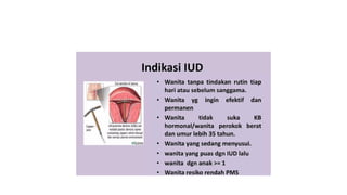 materi penyuluhan KB IUD power point.pptx