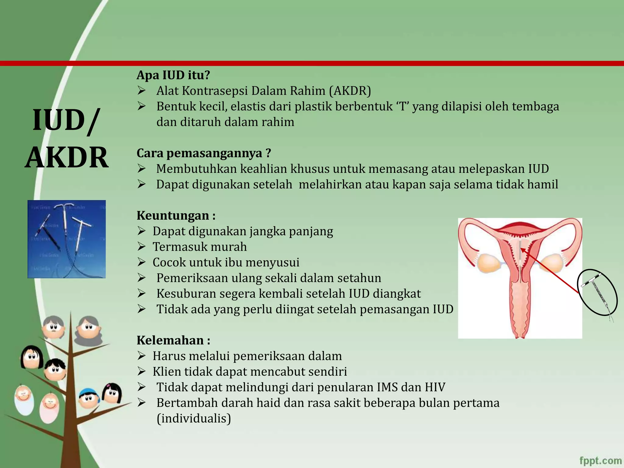 METODE KONTRASEPSI JANGKA PANJANG | PPTX