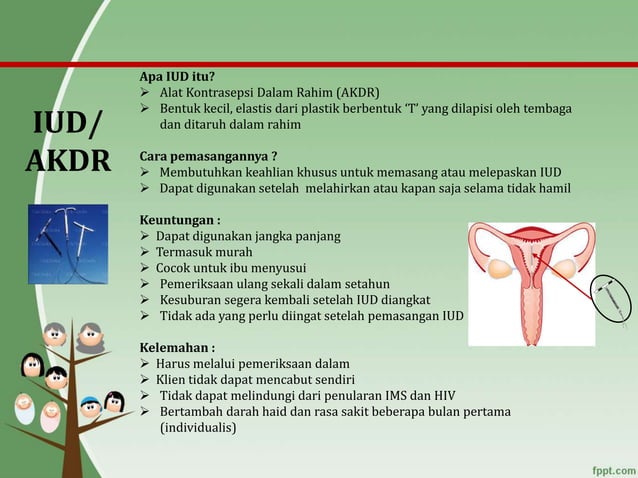 METODE KONTRASEPSI JANGKA PANJANG | PPTX