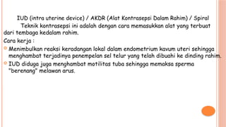 PPT alat kontrasepsi jangka panjang untuk pasangan usia subur | PPTX