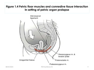 Kb revised management session on pelvic organ prolapse | PPTX