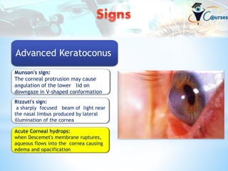 Keratoconus | PPTX