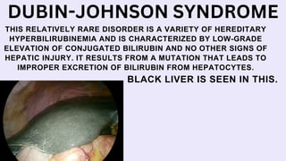jaundice - bilirubin metabolism, jaundice classification | PDF
