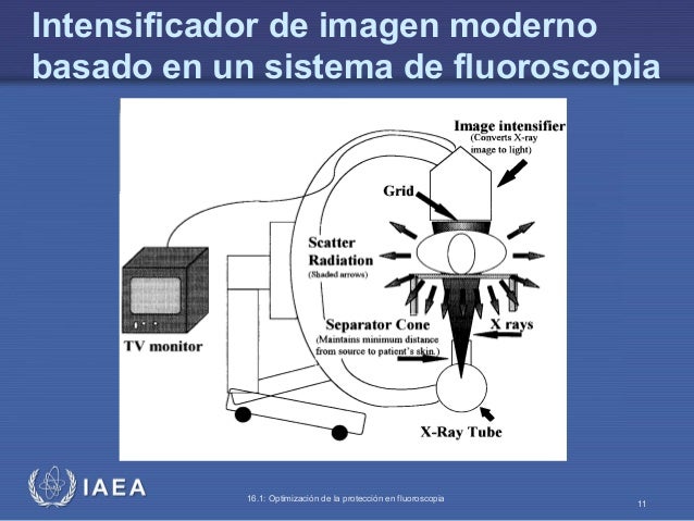 Clase de fluoroscopia digital