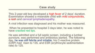 Kawasaki disease | PPT