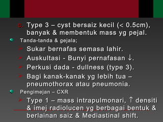 KEABNORMALAN KONGENITAL – SISTEM PERNAFASAN | PPT