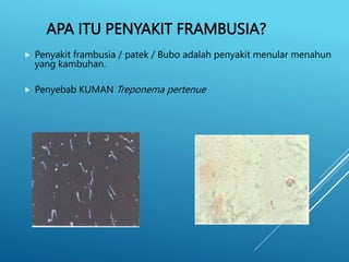 KEBIJAKAN, DIAGNOSA & TATALAKSANA FRAMBUSIA.ppt