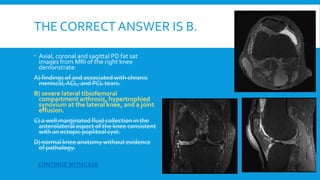 April 2014: Case of the Month, SIR-RFS | PDF | Bone and Joint ...