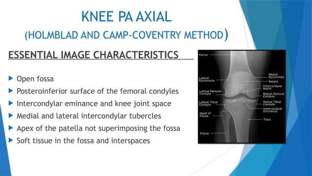 Knee radiographic positioning Keerthana knee[1].pptx