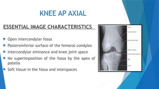 Knee radiographic positioning Keerthana knee[1].pptx