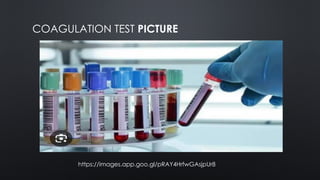 Laboratory Methods used in the Investigation of Coagulation Disorders ...