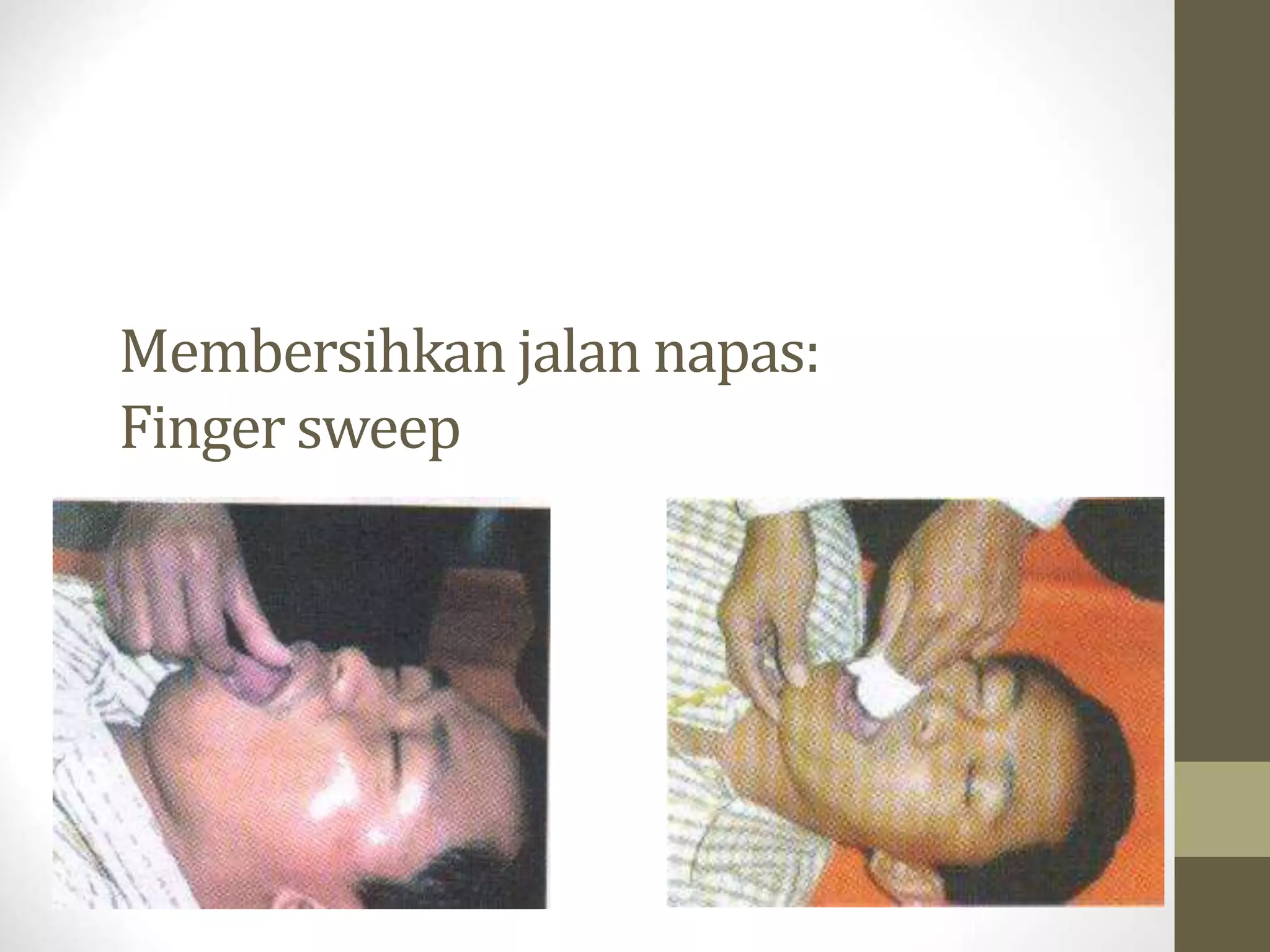 Kegawatdaruratan.ppt