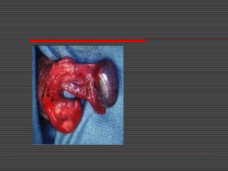 KEGAWATDARURATAN-UROLOGI-emergency uro.ppt