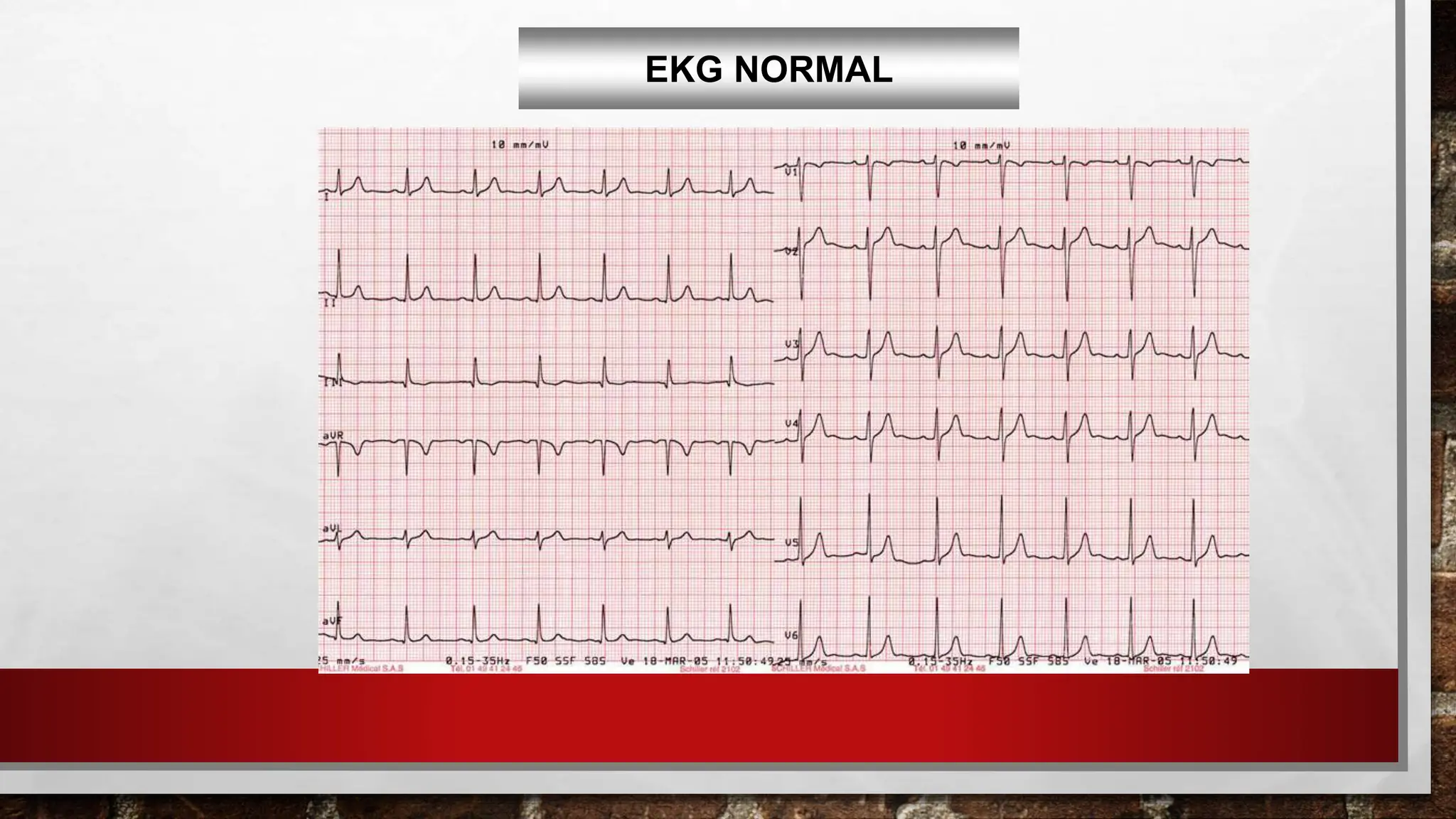 Kegawatdaruratan dan EKG (1).pptx