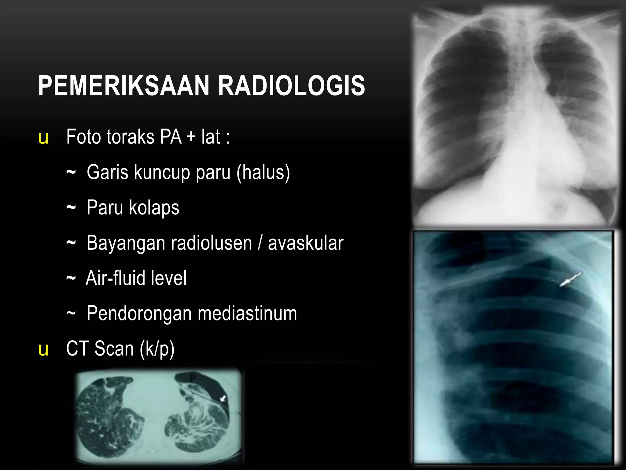 kegawatdaruratan paru.ppt
