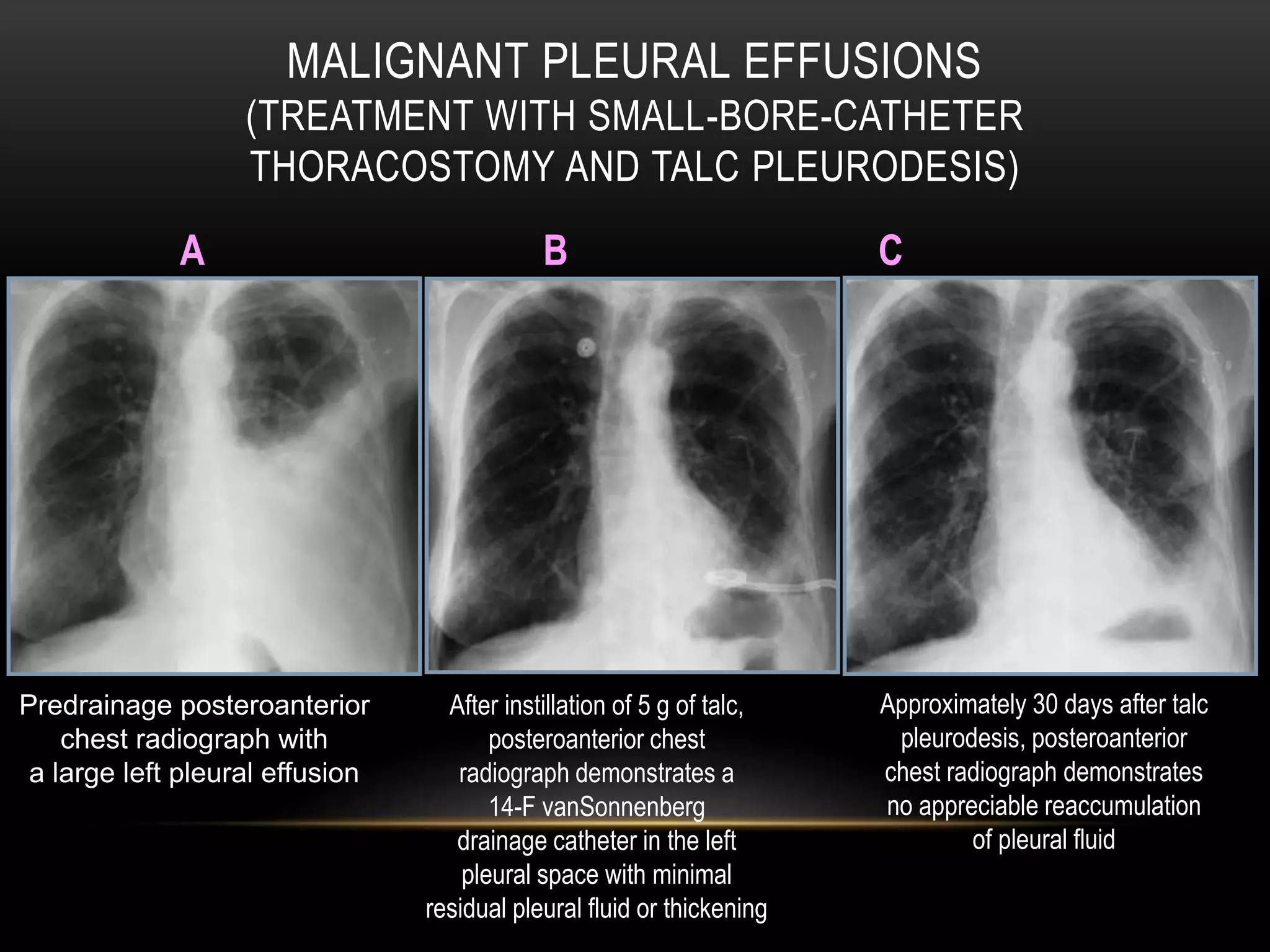 kegawatdaruratan paru.ppt