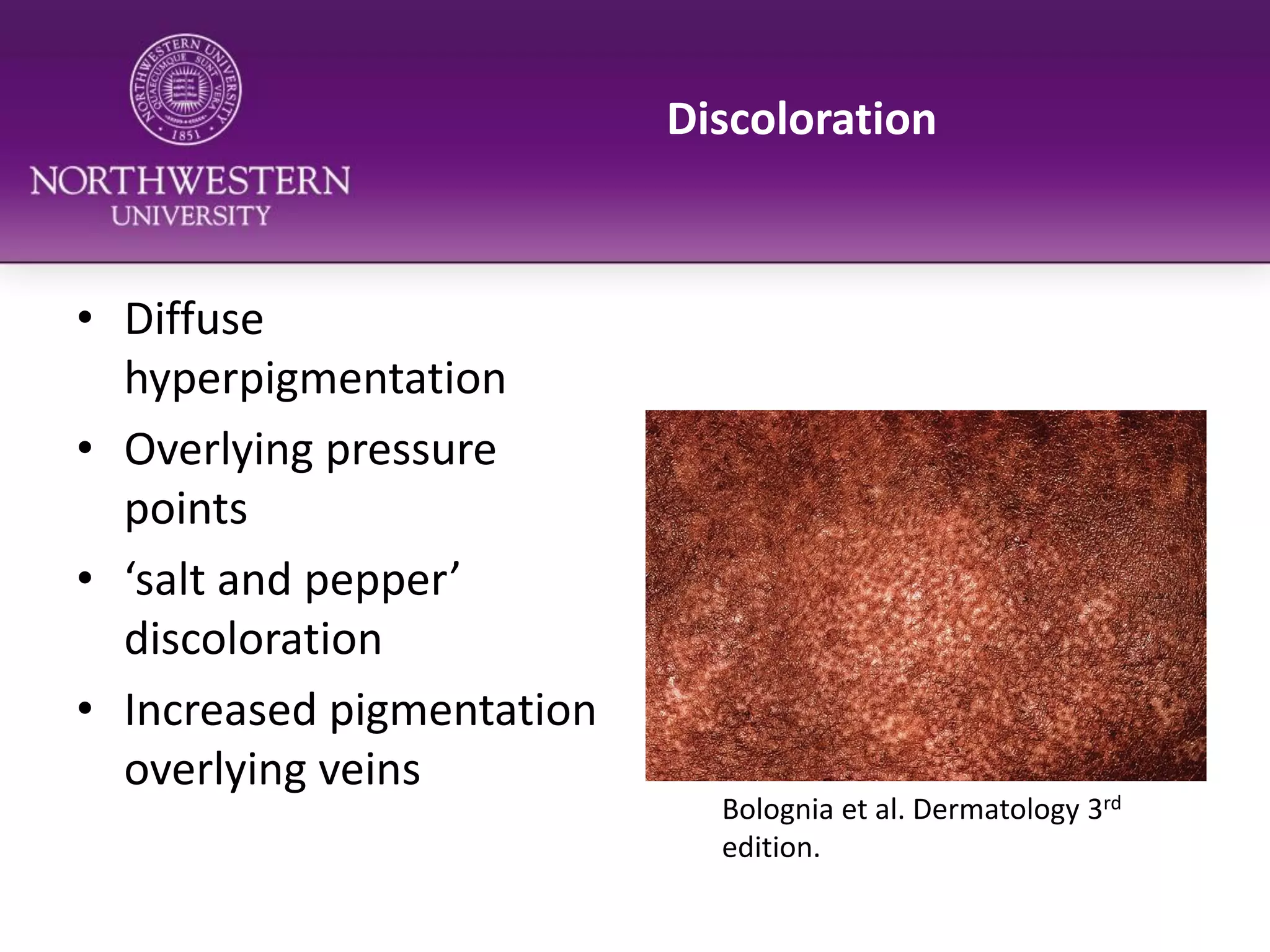 Skin Complications in Scleroderma | PDF