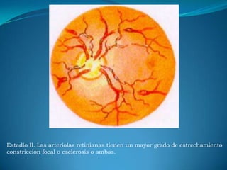 Imagenes clasificacion Keith wagener | PPTX