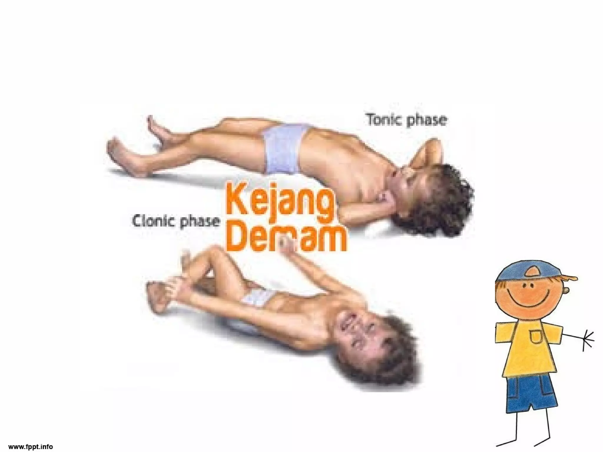 Kejang demam ppt | PPT