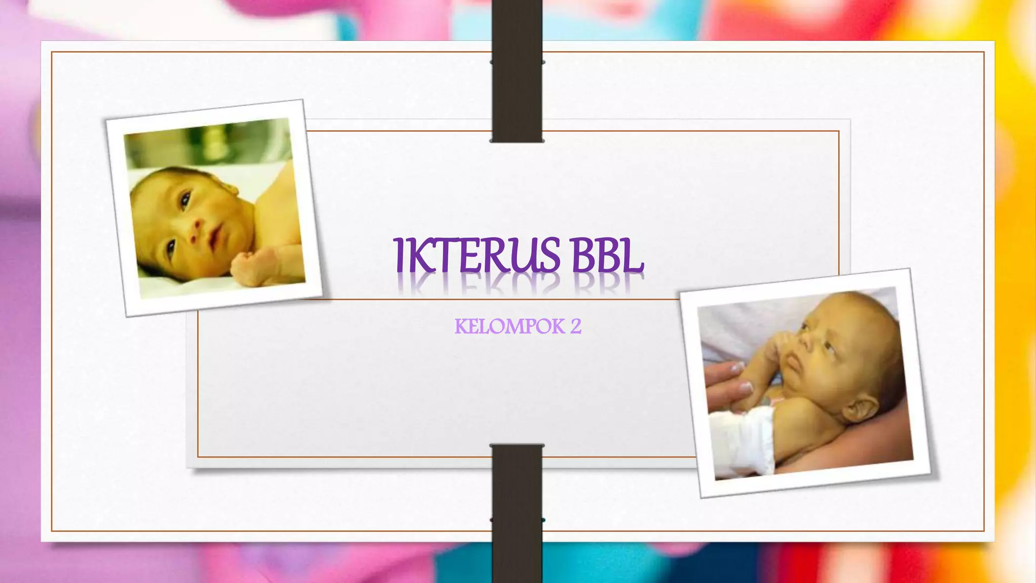 Ikterus Neonatorum | PPTX