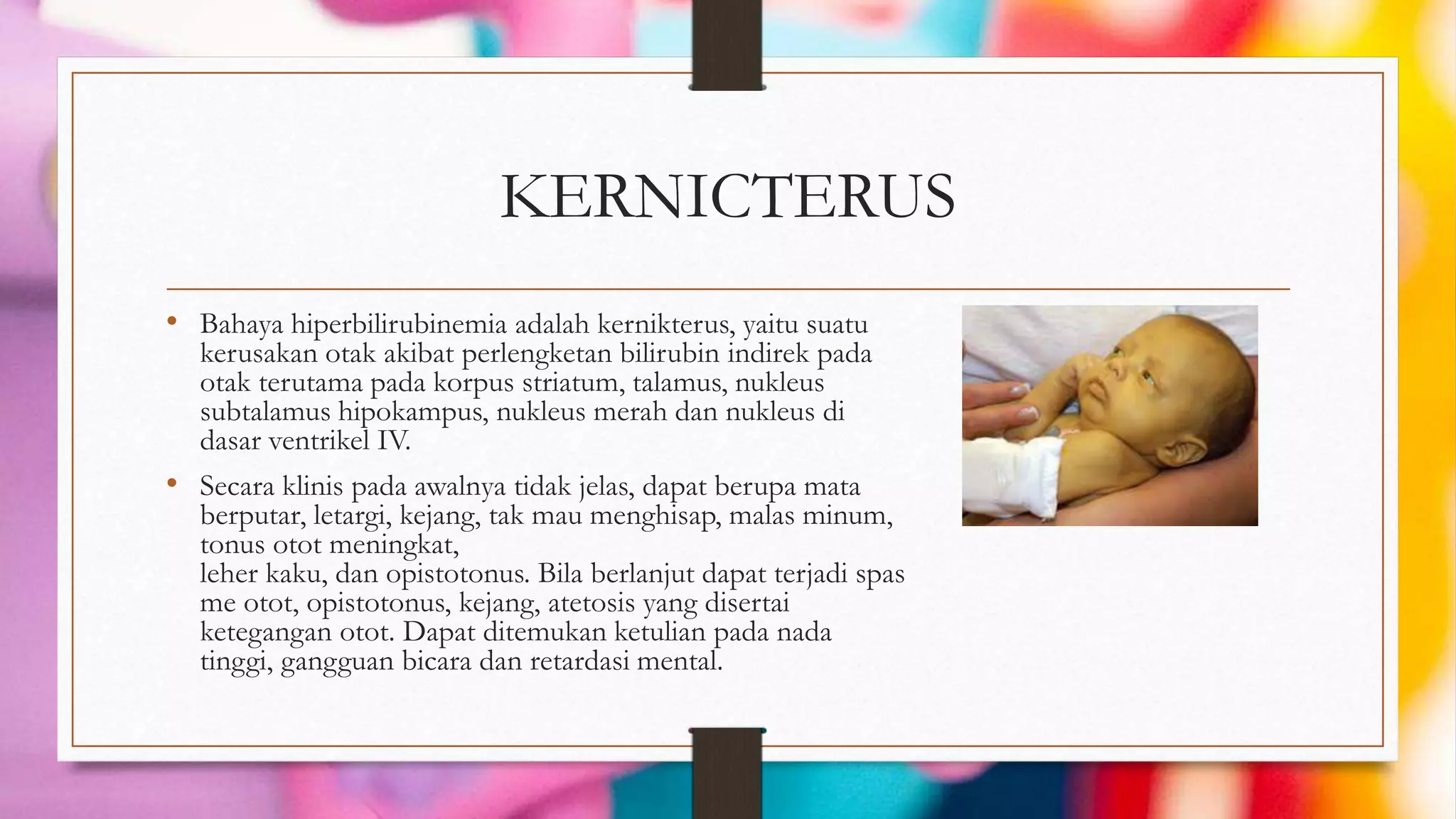 Ikterus Neonatorum | PPTX