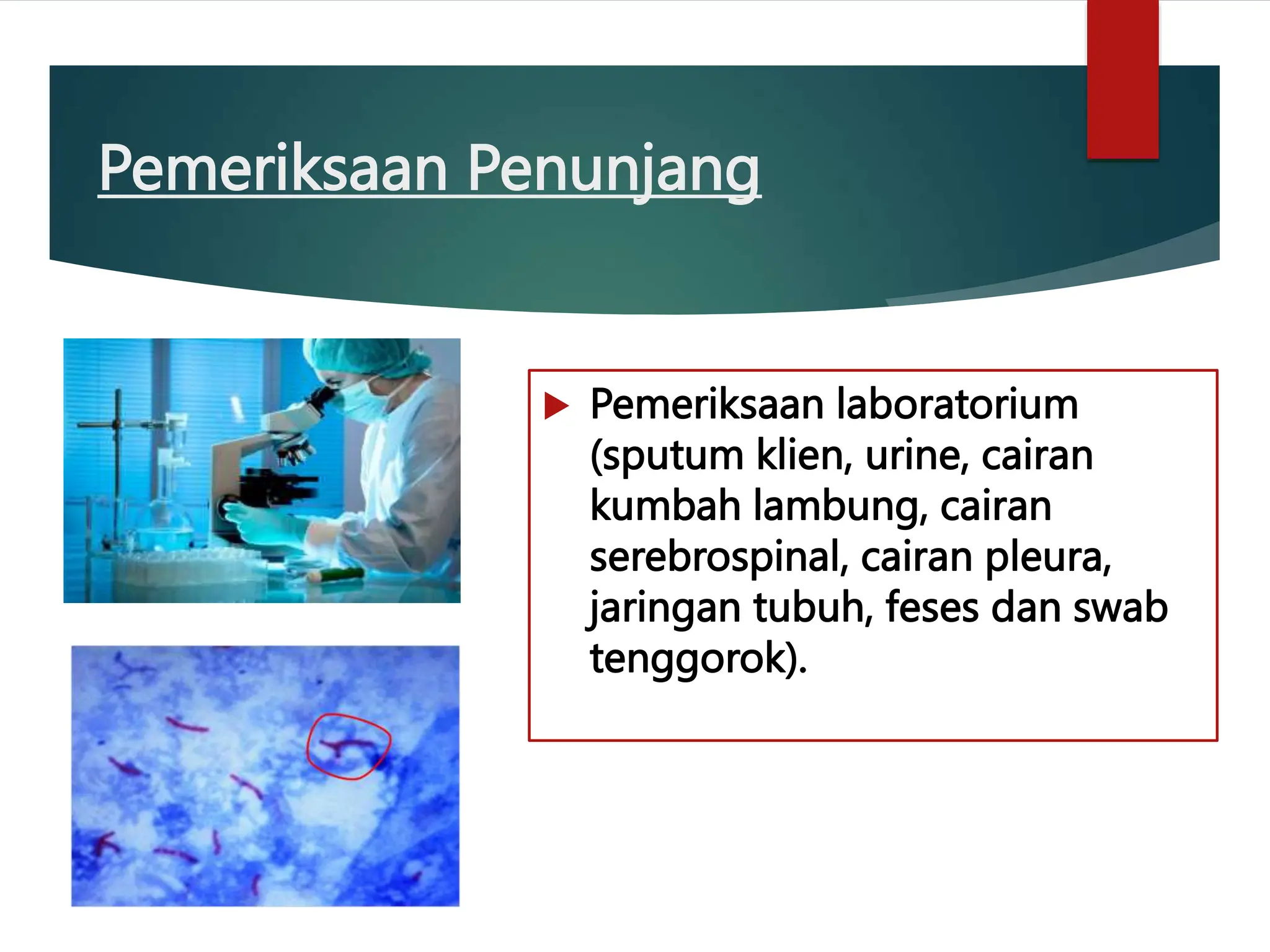 KEL 4 - ASKEP TBC PADA ANAK FIX (1).pptx