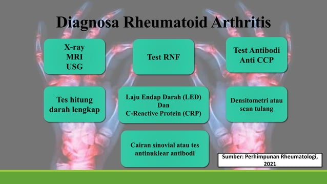 KEL 4 RHEUMATOID ARTHRITIS.pptx