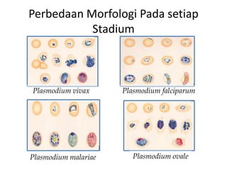Kel 5 plasmodium malariae | PPTX