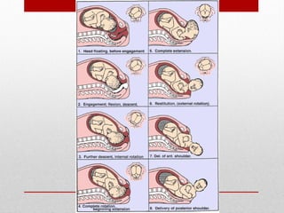 KELAHIRAN NORMAL | PPT