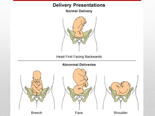 KELAHIRAN NORMAL | PPT