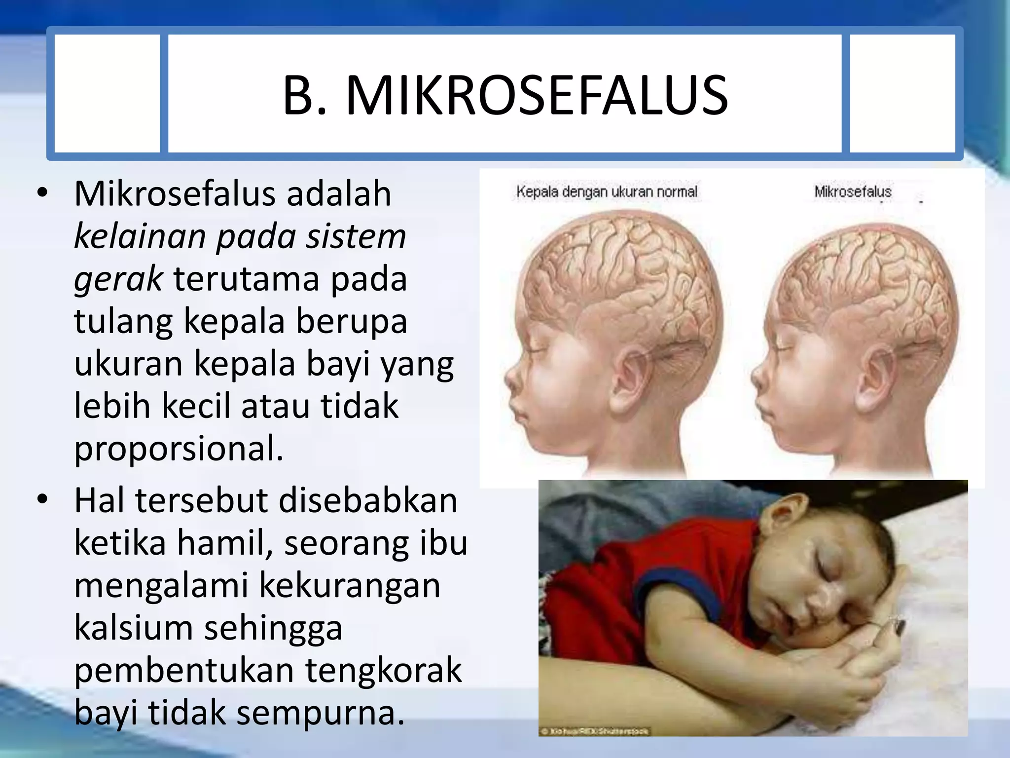 Kelainan dan penyakit pada sistem gerak manusia ppt.docx