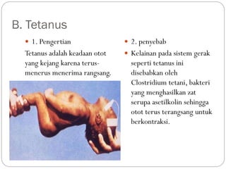 Kelainan dan penyakit pada sistem gerak manusia ppt.docx
