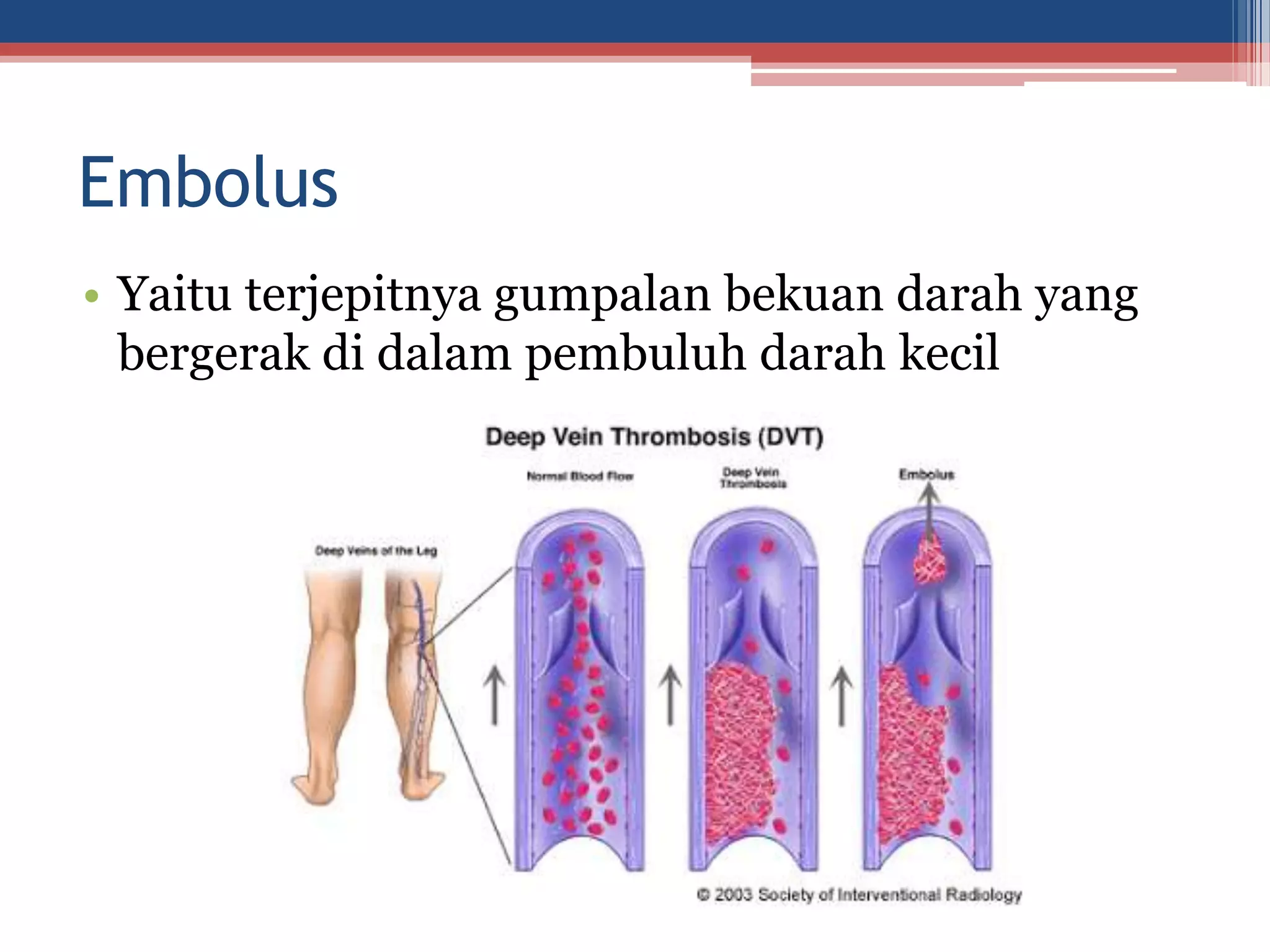 Kelainan dan Gangguan Sistem Sirkulasi Darah | PPT