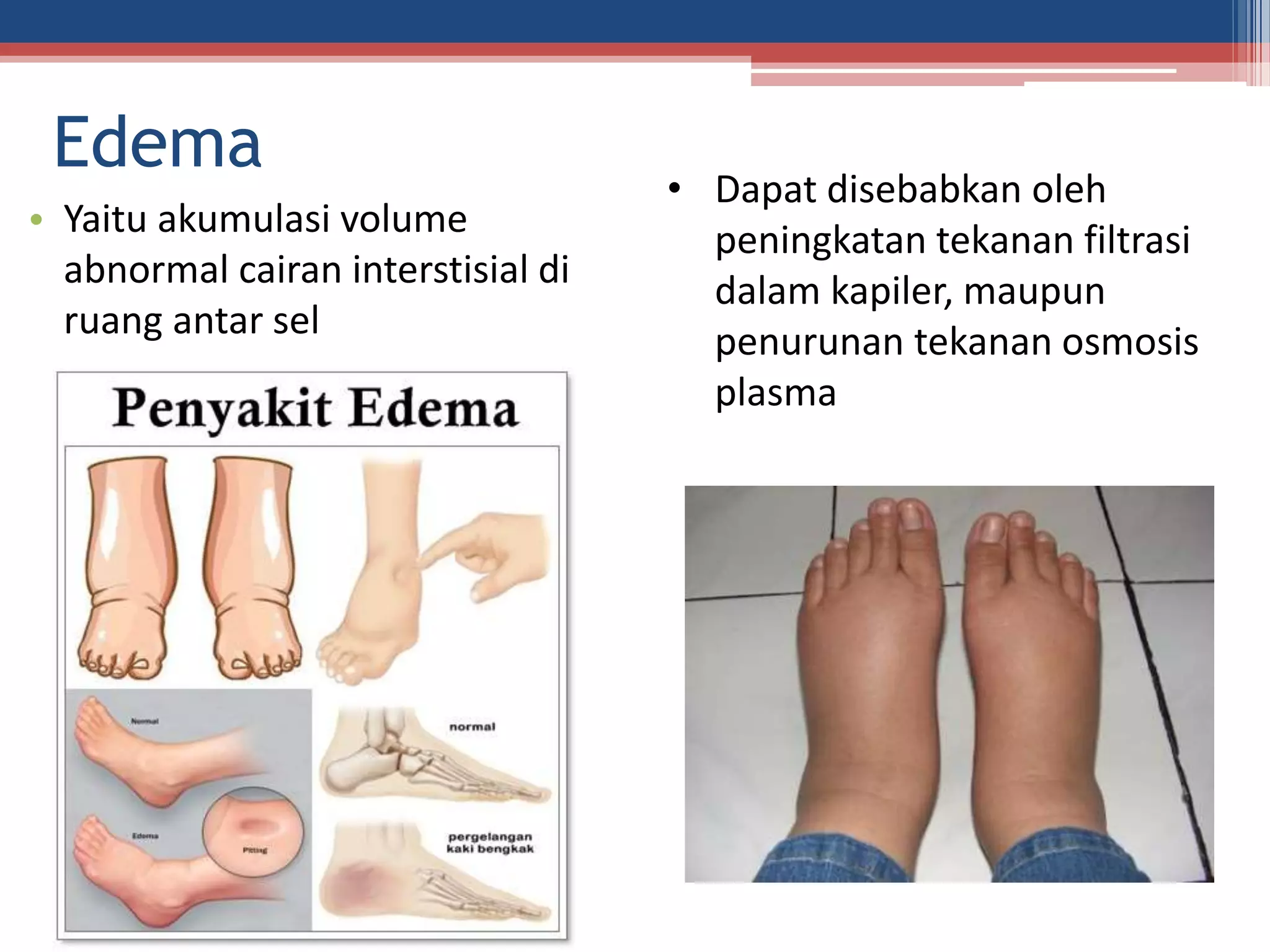 Kelainan dan Gangguan Sistem Sirkulasi Darah | PPT