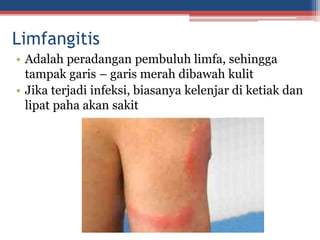 Kelainan dan Gangguan Sistem Sirkulasi Darah | PPT