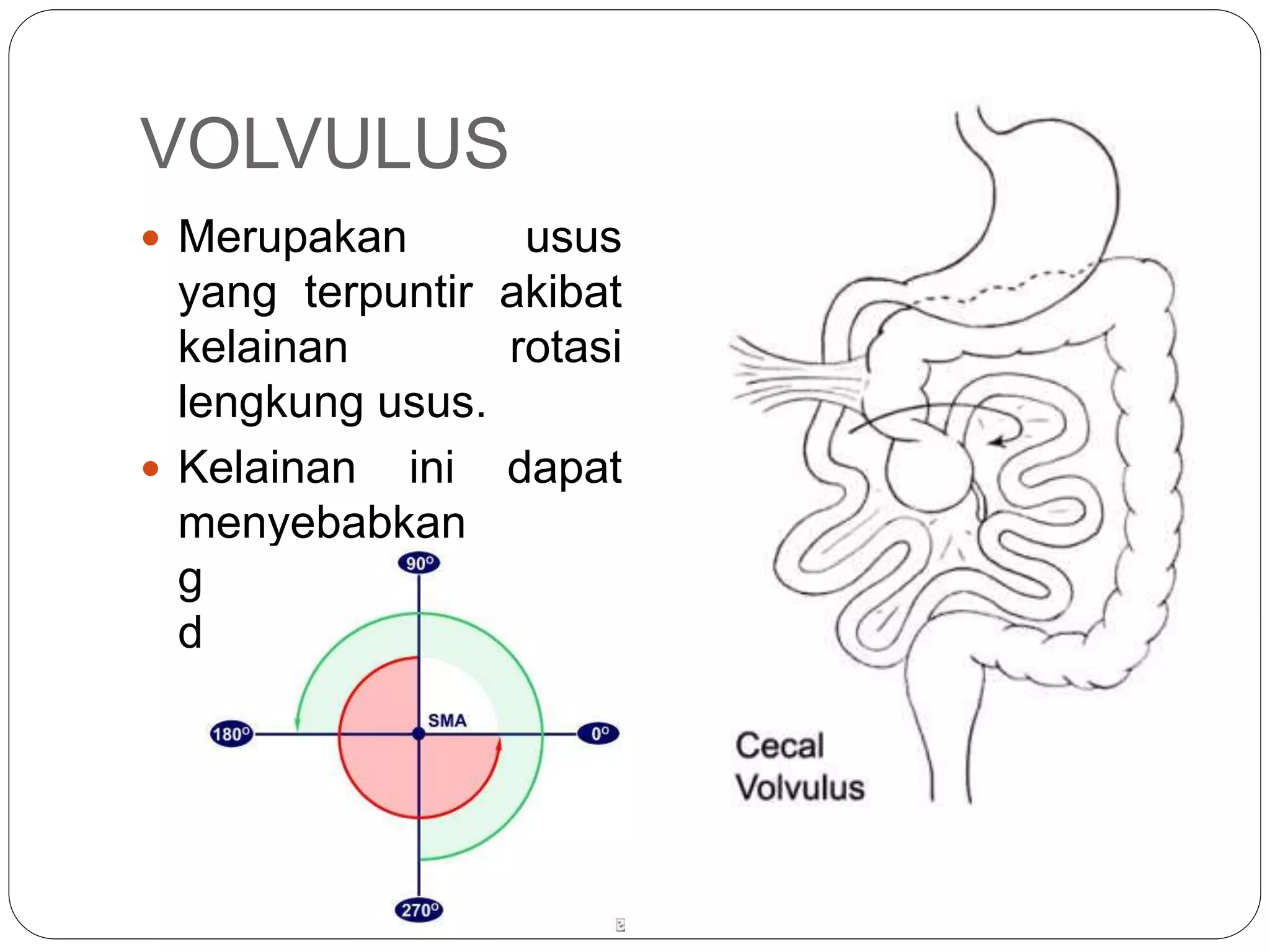 Kelainan genetik perkembangan sistem digestif | PPT