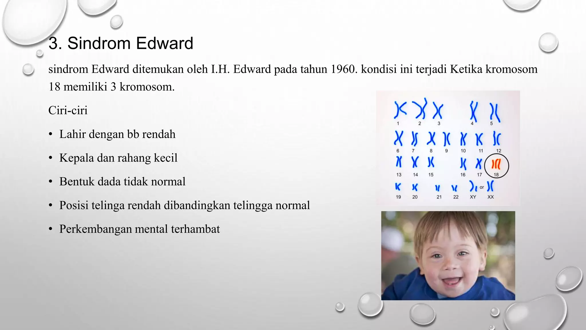 KELAINAN KONGENITAL.pptx