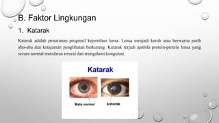 KELAINAN KONGENITAL.pptx