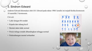 KELAINAN KONGENITAL.pptx