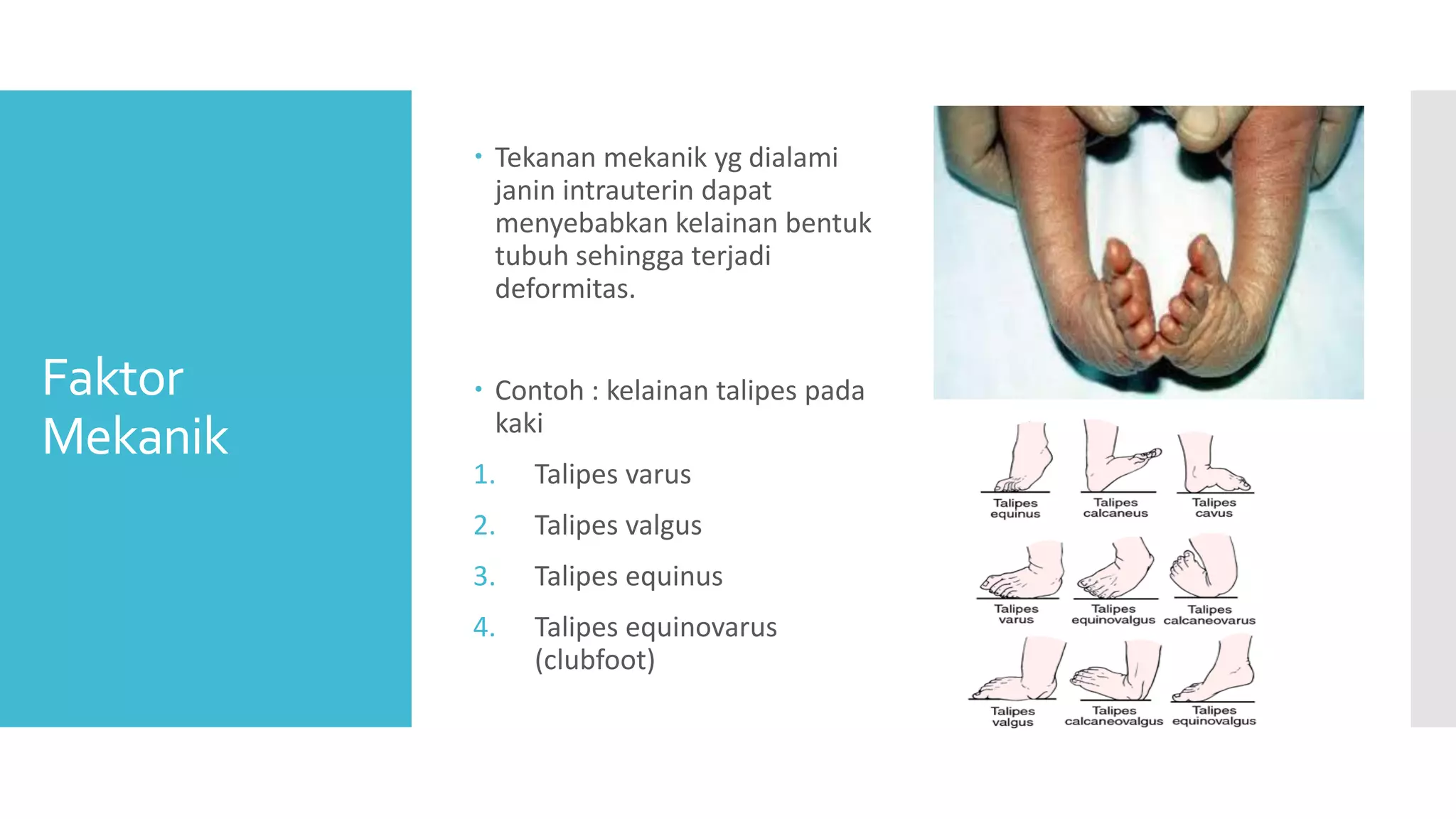 KELAINAN KONGENITAL.pdf