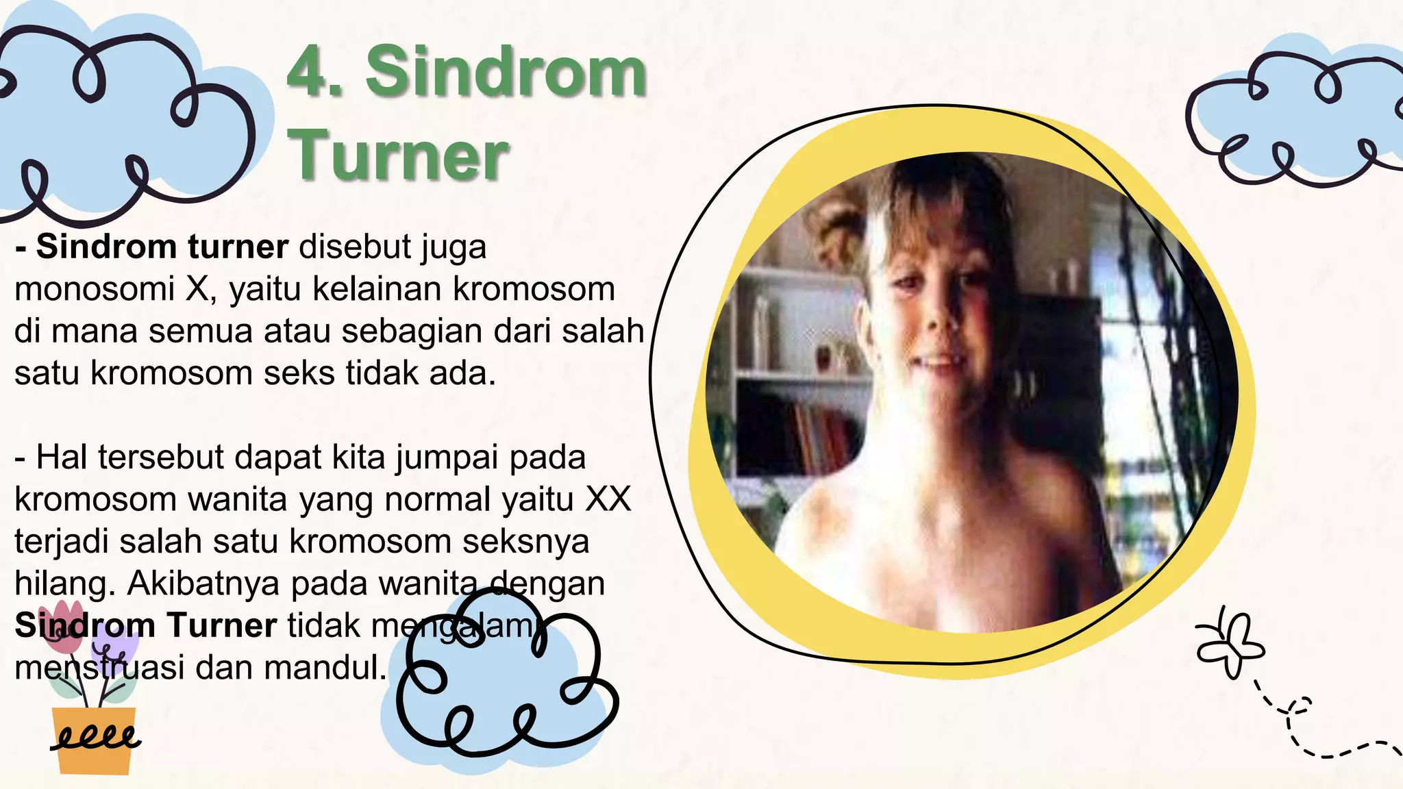 Kelainan kromosom numerik - PPT | PPTX