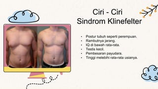 Kelainan kromosom numerik - PPT | PPTX