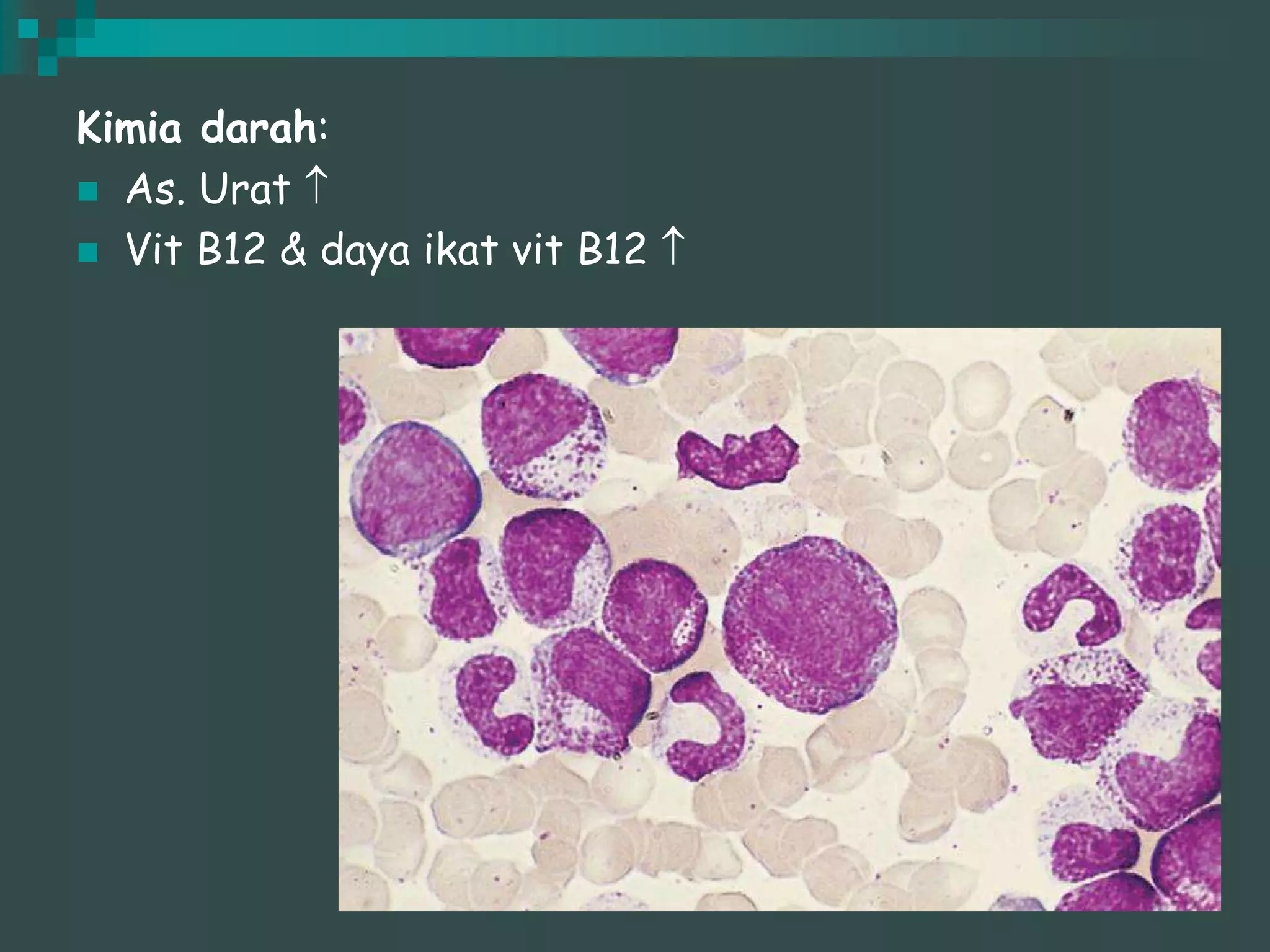 KELAINAN LEUKOSIT.pdf