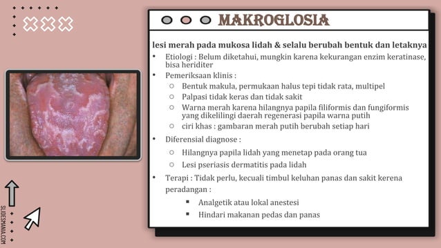 Kelainan Lidah.pptx