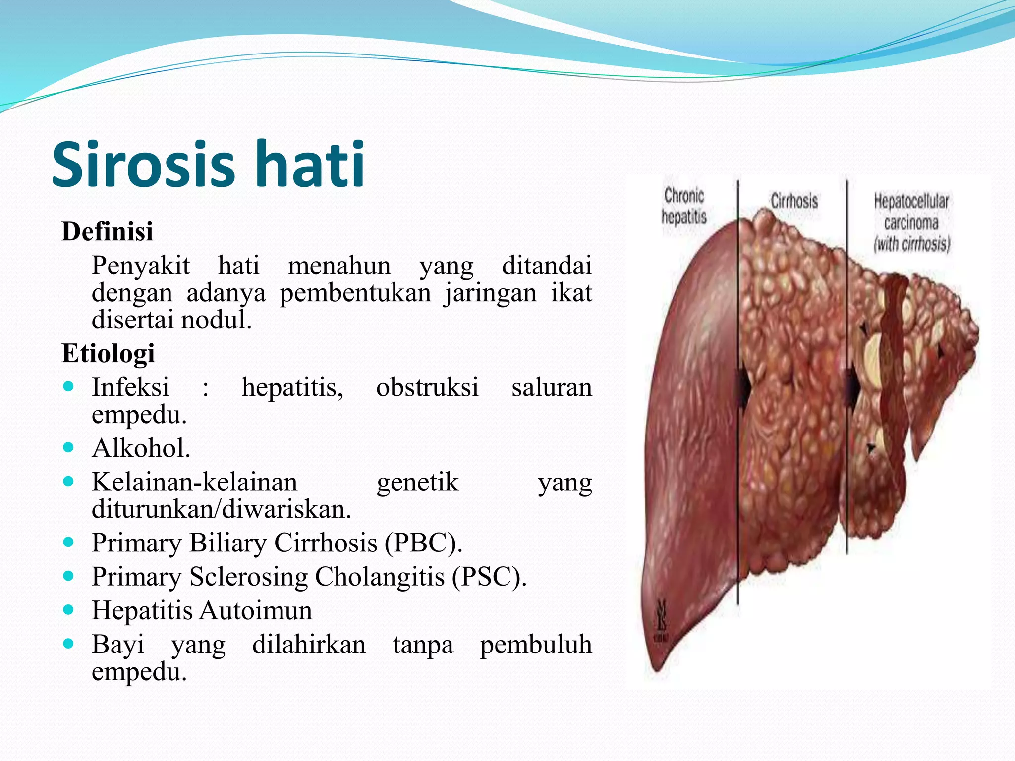 Kelainan pada hati | PPTX